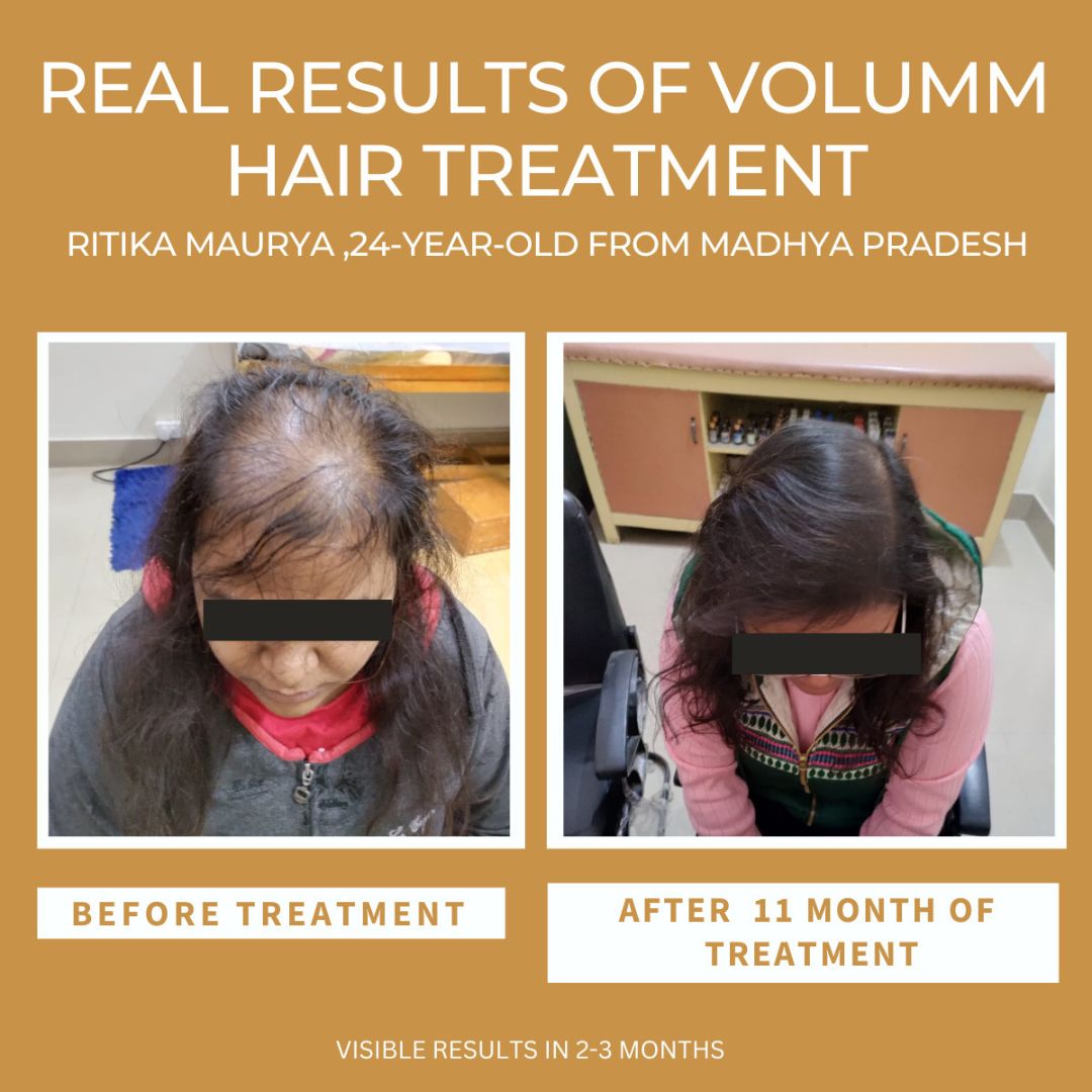 Dermatologically Tested Customised Hair Care Products by Razorveda – M ...