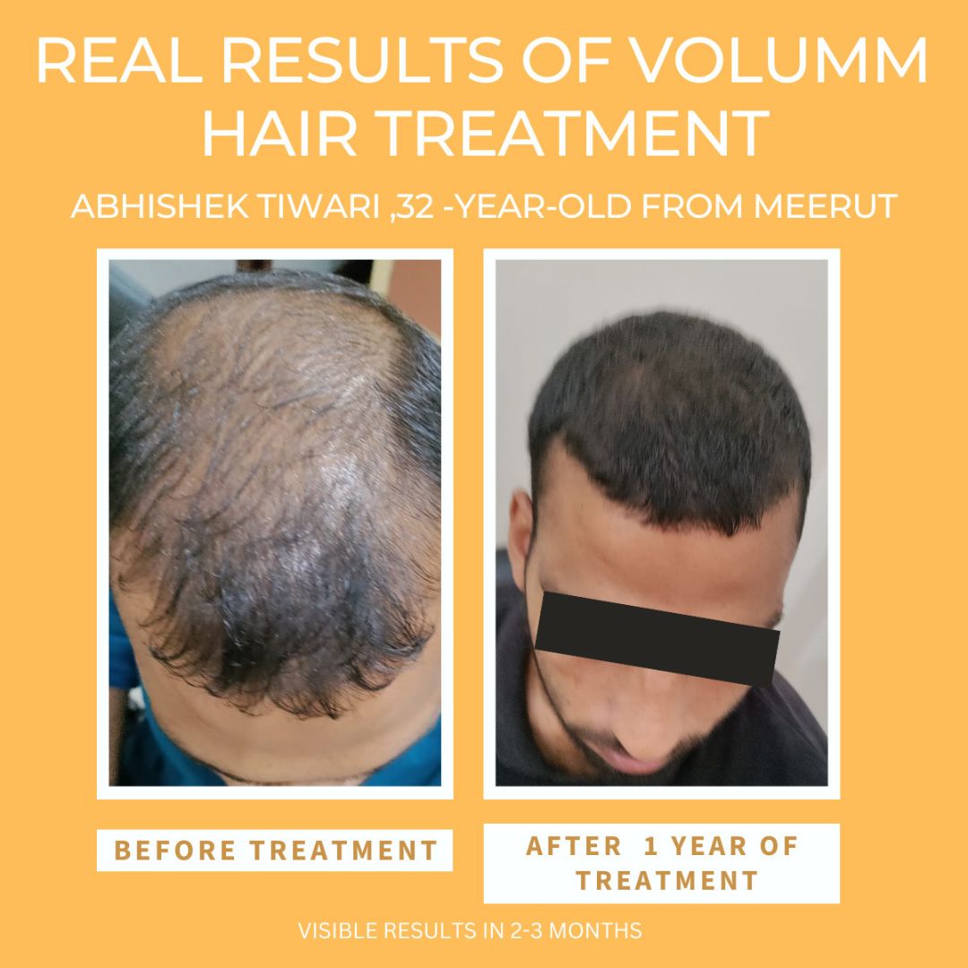 Dermatologically Tested Customised Hair Care Products by Razorveda – M ...